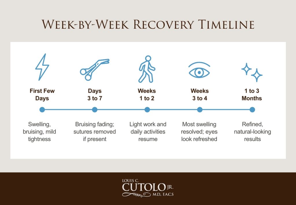 What Is a Typical Eyelid Surgery Recovery Timeline? – Louis C. Cutolo ...